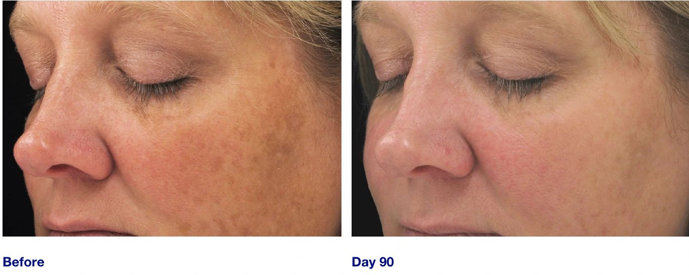 iS Clinical Brightening Complex 30g - Pinnacle Wellness